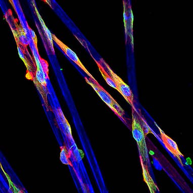 Gallery: The Year's Best Photomicrography | Popular Photography